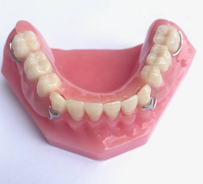 Choosing the Best Partials to Help Restore Your Smile
